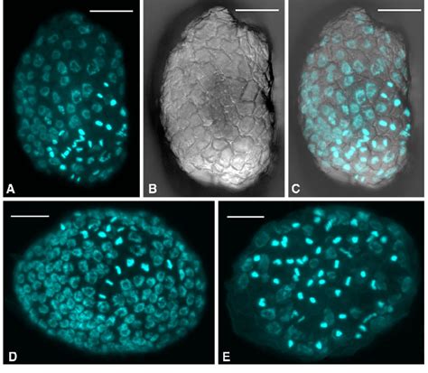 Dapi Fluorescence A D E Transmission Light B And Overlay C