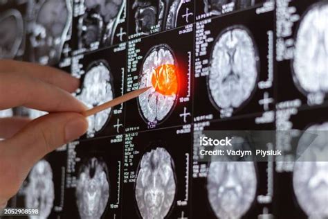 Mri Mrt Ct 스캔을 검사하는 의사 인간 뇌의 이미지 의료 Treatmant 개념 인간의 머리 질병의 진단 닫습니다 Mri 스캔에 대한 스톡 사진 및 기타 이미지