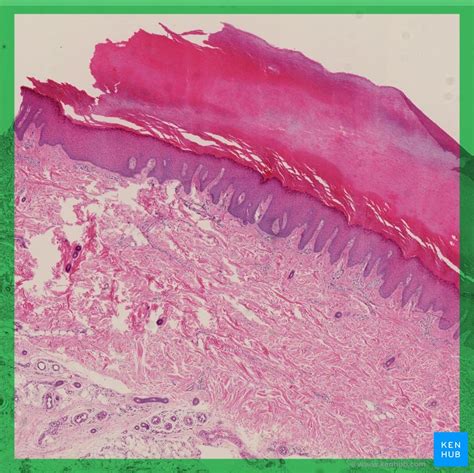 Epithelial Tissue Definition Functions Examples Kenhub