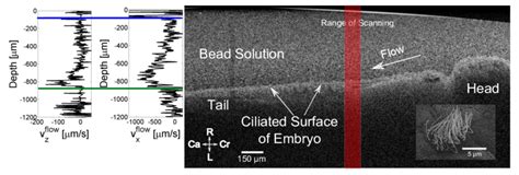 In Vivo Demonstration Of Directional Dls Oct Protocol In X Laevis