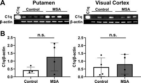 Comparison Of Complement Factor C1q Levels In The Putamen And Visual Download Scientific