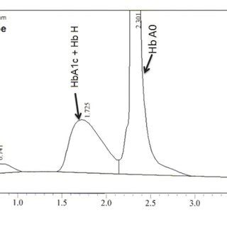 Chromatogram Of HbA1c With HPLC HbA1c And Hb H Peaks Were Thought To Download Scientific