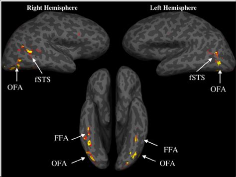 101 7 Areas Associated With Face Recognition Based On Fmri Three Download Scientific Diagram