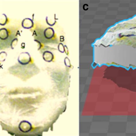 A Axial Ct Scan Of An Anthropomorphic Phantom With Overlying 3d Printed