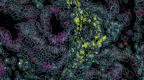 Cosmx® Smi Brochure Nanostring