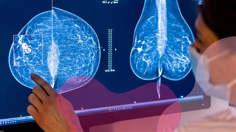 Screening Vs Diagnostic Mammogram Purpose Protocol And Results
