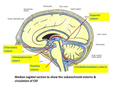 Basal Cisterns
