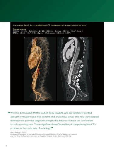 Philips Phillips Brilliance Ict 256 Slice Ct Scan At ₹ 17745000 In Faridabad