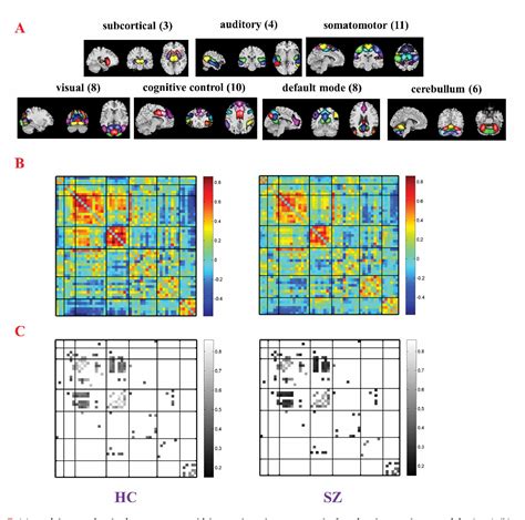 Figure 1 From Application Of Graph Theory To Assess Static And Dynamic Brain Connectivity