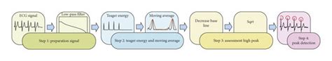 The Diagram Block Shows 4 Steps Of Qrs Complex Detection Download Scientific Diagram