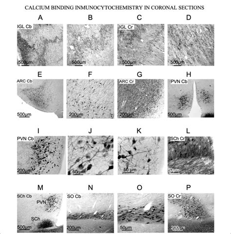 Figure Calcium Binding Protein Immunoreactivity Of The Nuclei Of Download Scientific Diagram
