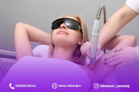 مراقبت های بعد از لیزر موهای زائد