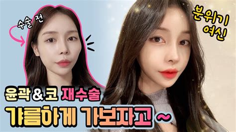 코성형브이로그 예쁜데 더 예뻐졌다😍 👉윤곽재수술광대 앞턱 코재수술 성형브이로그코수술브이로그코재수술코수술후기코성형후기 Youtube