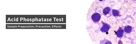 Acid Phosphatase Test Sample Preparation Precaution Effects