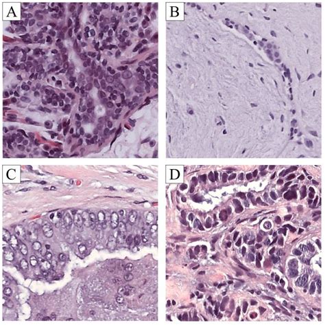 Examples Of The Patches Extracted From Used Dataset Due To The