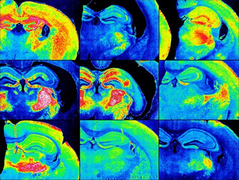 Identification Of Prion Diseases Aided By Novel Marker Animal