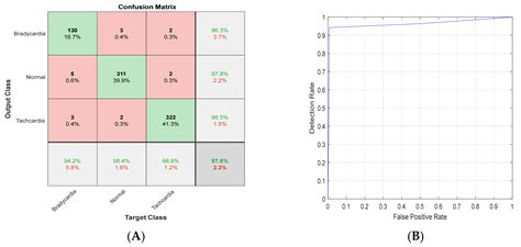 Diagnostics Free Full Text Advanced Time Frequency Methods For Ecg Waves Recognition