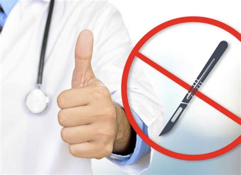No Scalpel Vs Traditional Vasectomy Key Differences Blog