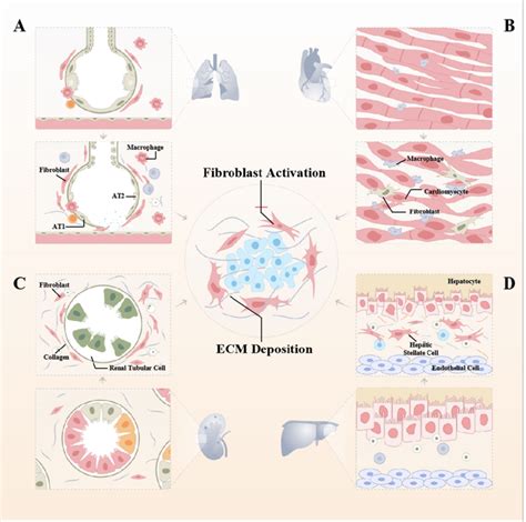 The Central Role Of Fibroblast Activation In The Pathogenesis Of Download Scientific Diagram