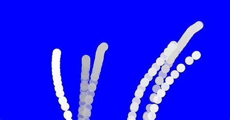 op7 swipe issue near bottom centre section after oos 11 0 2 1 update album on imgur