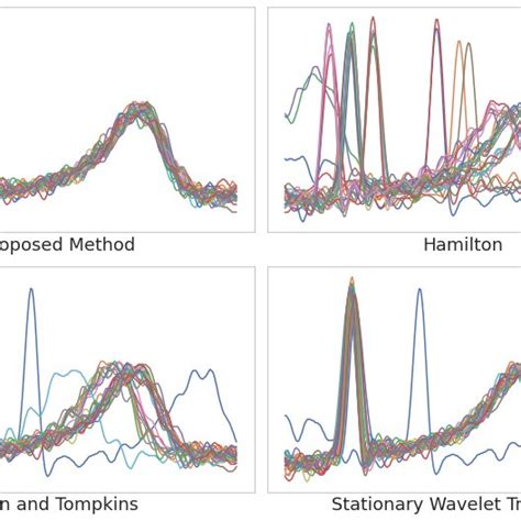 A Qualitative Evaluation Of The Proposed R Peak Detector A Presents Download Scientific