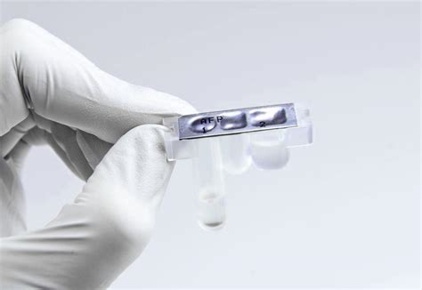 Lumipulse® G Hbcrag Cleia Clia Based Assay For Fully Automated Ivd Immunoassay Testing
