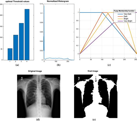 a 4 level of threshold optimization b histogram of input pneumothorax