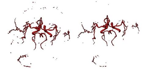 comparison of g mrf and double gaussian model segmentation result
