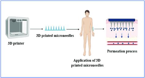 The 3d Printed Microneedles For Transdermal Drug Delivery Download Scientific Diagram