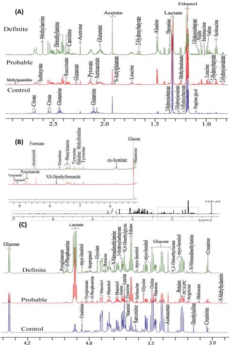 Stack Plot Of Cumulative 1d ¹h Nmr Spectra Of Csf Samples Showing