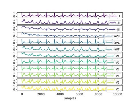 Ecg — Neurokit2 0212 Documentation