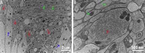 Neuron Synapse Microscope