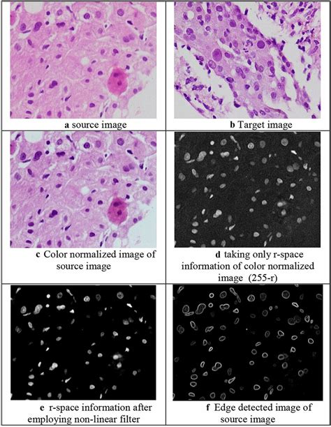 Color Normalization And Edge Detection Of Histopathology Image Download Scientific Diagram
