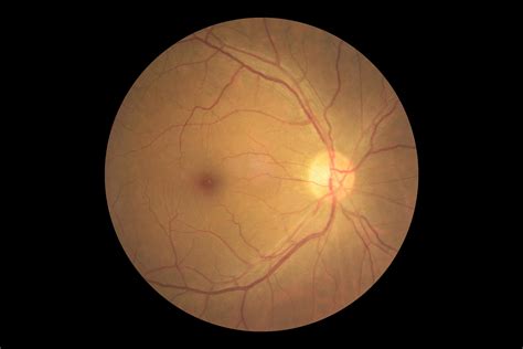 Improving Robustness And Reliability In Medical Image Classification