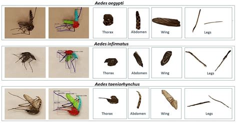 A Framework Based On Deep Neural Networks To Extract Anatomy Of