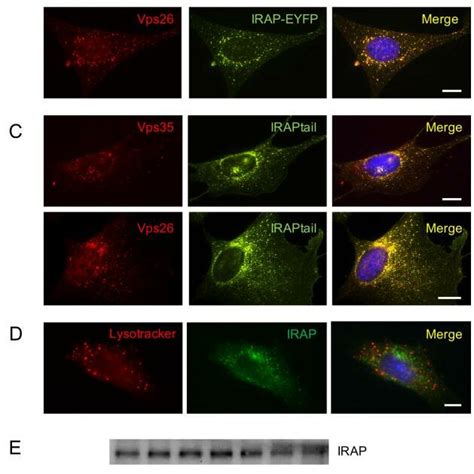 Knock Down Of Irap Using Sirna Does Not Affect Formation Of The Irvs Download Scientific