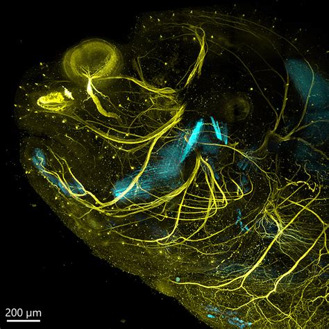 Confocal Microscopy
