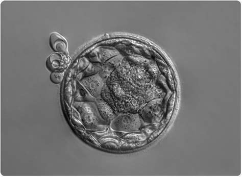 What Is Gastrulation