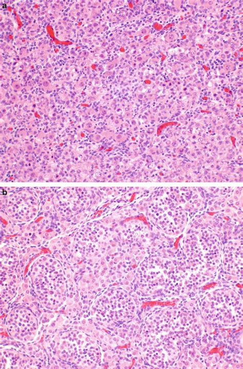 Normal Histology Of The Female Genital Tract Basicmedical Key