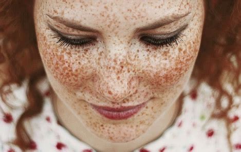 Een Ode Aan Iedereen Met Sproetjes Cvandaag Nl