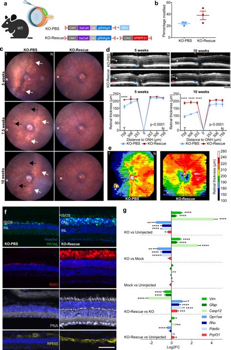 Gene Augmentation Prevents Retinal Degeneration In A Crispr Cas9 Based Mouse Model Of Prpf31