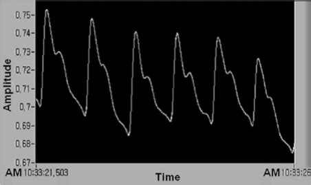 Typical Pulse Waveform Of 1 Point Obtained By The Compositional Download Scientific Diagram