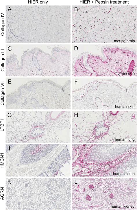 Use Of Pepsin Treatment To Enhance Antibody Detection Of Extracellular Download Scientific