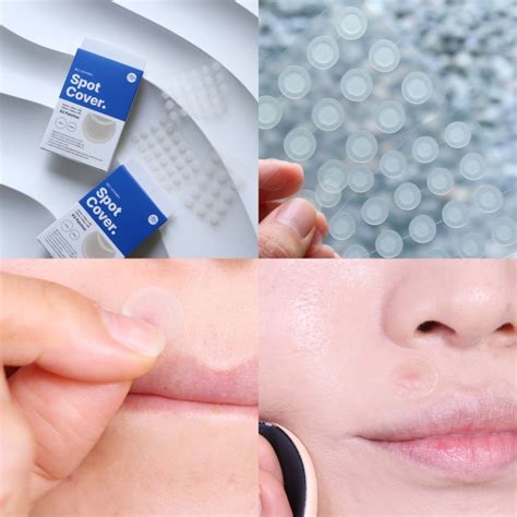 여드름패치추천 뾰루지 손대지 말고 올담 스팟커버패치 네이버 블로그