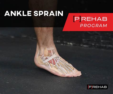 Ankle Sprain P Rehab Program The Prehab Guys