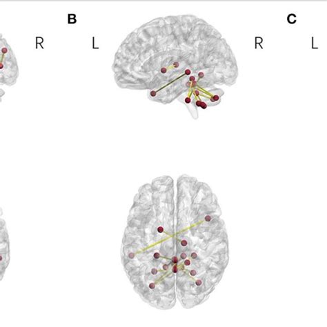 Brain Connectivity Patterns For The Three Correlation Methods A