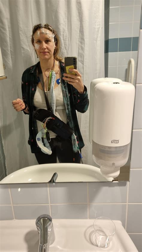 My First 24 Hour Eeg At The Epilepsy Center Repilepsy