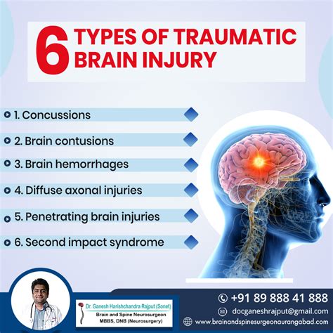 6 Types Of Traumatic Brain Injury • Concussions • Brain Contusions • Brain Hemorrhages • Diffuse