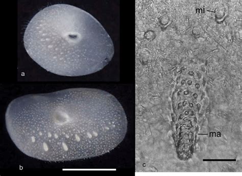Photographs Of Elytra Of Hesperonoe Hwanghaiensis Uschakov And Wu 1959 Download Scientific