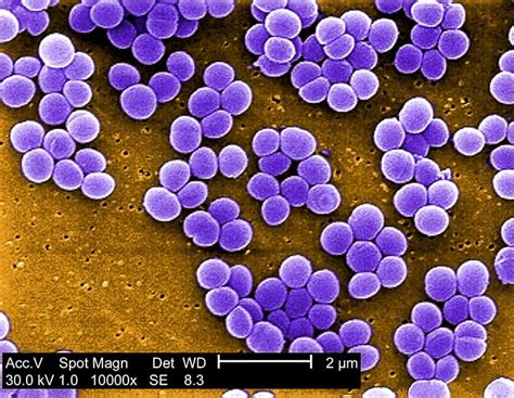 Free Picture Staphylococcus Aureus Bacteria Vancomycin Intermediate Resistant Culture Visa